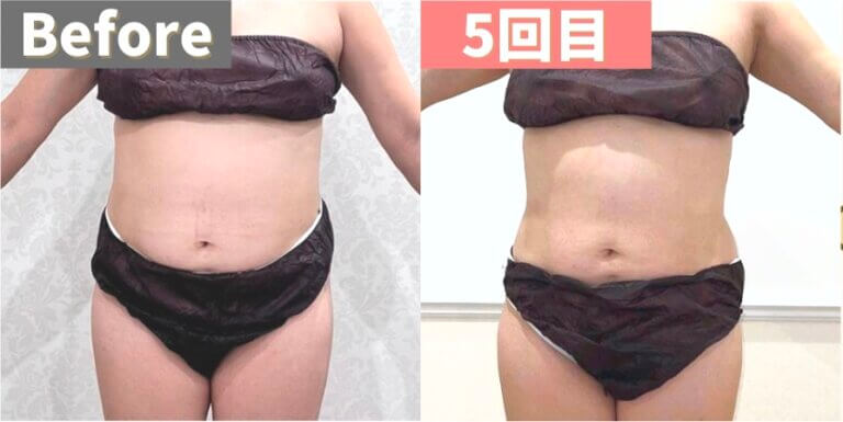 「今年こそ痩せたい!」そう思いながら5月を迎えたあなたへ。。。 茗荷谷 本郷三丁目 春日の人気美容室 Beautism【ビューティズム